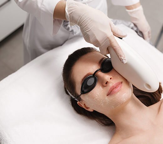 Photofacial – Cosmetic Laser Clinics